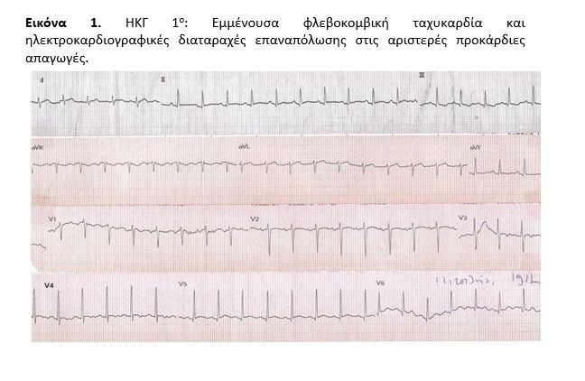 7.1 Μυοκαρδίτιδα Long COVID | Ελληνική Καρδιολογική Εταιρεία
